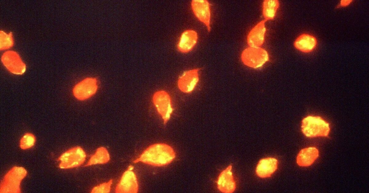 Science & Cocktails: What can we learn from parasites? | Paradiso